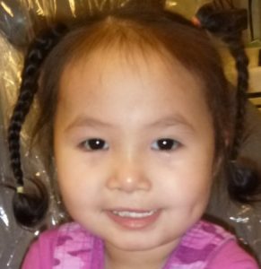 Cleft Lip & Palate for Anchorage, Wasilla, & Palmer, AK – Plastic ...